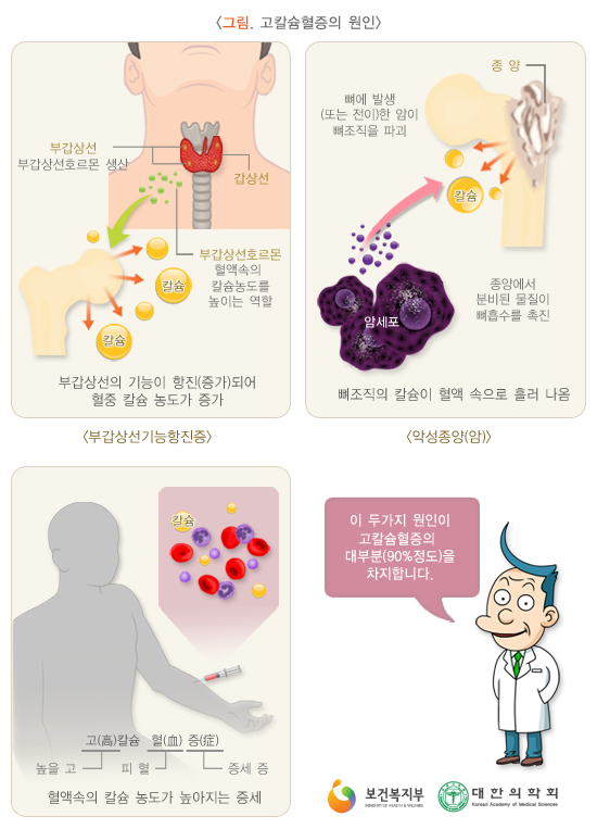 고칼슘혈증고칼슘혈증의 원인 네이버 블로그