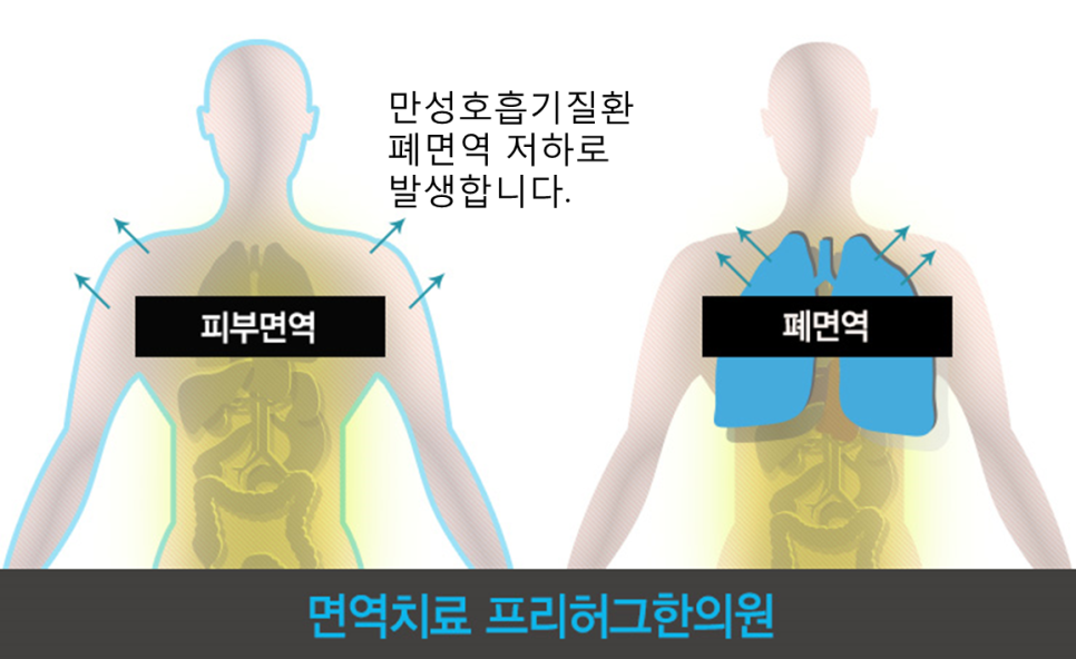 만성호흡기질환의 종류와 치료접근법 네이버 블로그