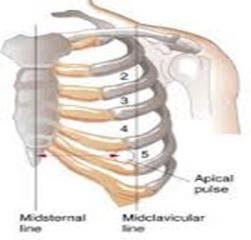 성인간호학 목록열기 (15) - 간호학 - 향기있는 쉼터