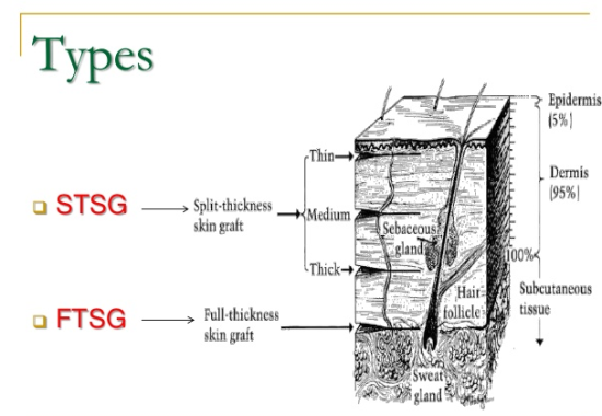 Skin graft(피부이식술, STSG & FTSG) : 네이버 블로그