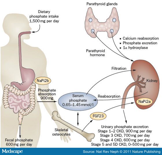 Chronic Kidney Disease, 임상양상 및 합병증, Hyperkalemia, Hyperphosphatemia ...